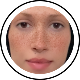 freckles | Search Snapchat Creators, Filters and Lenses