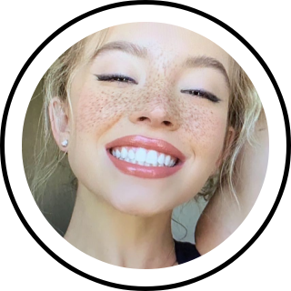 freckles | Search Snapchat Filters and Lenses
