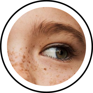freckle | Search Snapchat Filters and Lenses