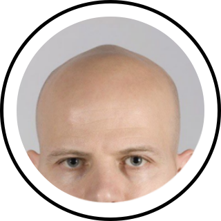 bald | Search Snapchat Filters and Lenses