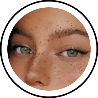 freckles | Search Snapchat Creators, Filters and Lenses