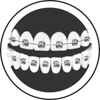 braces | Search Snapchat Creators, Filters and Lenses