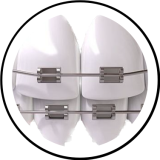 braces | Search Snapchat Creators, Filters and Lenses